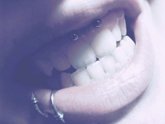 Smiley Piercing: 44 Peeps Who Are Rocking Their Smile + Tips!